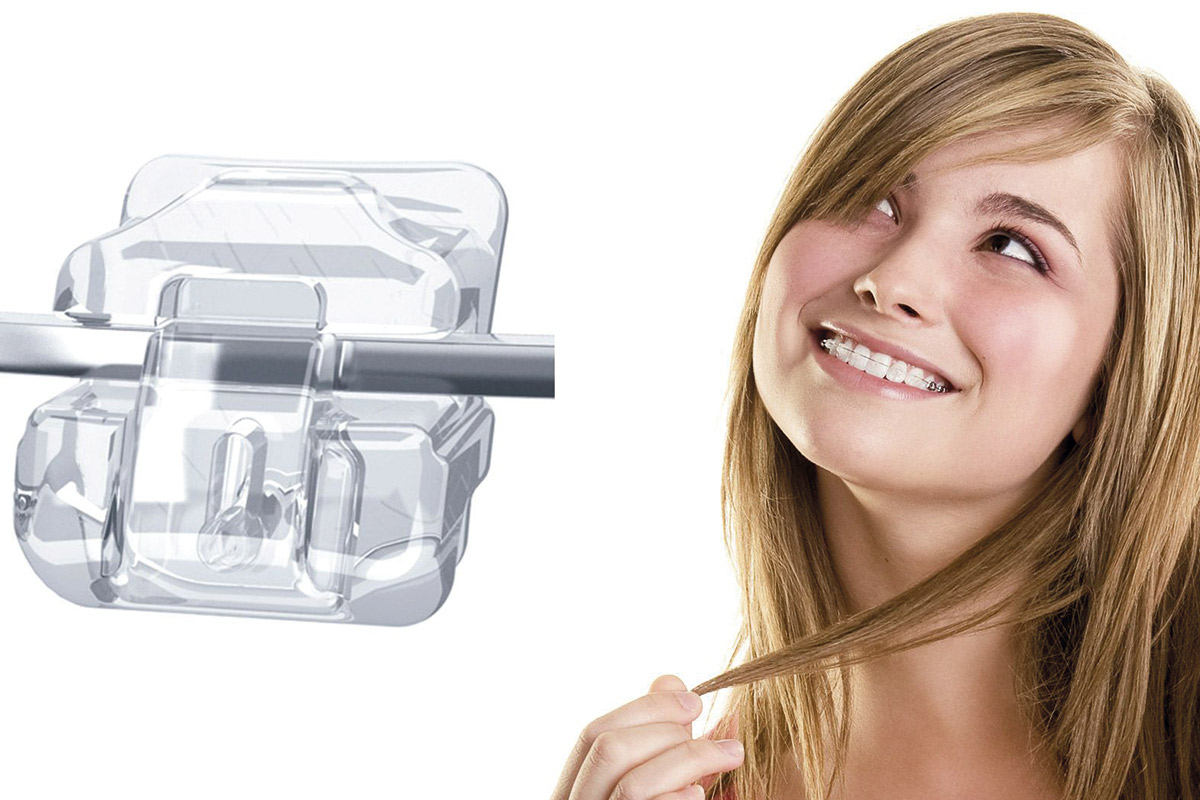 Tratamientos con Brackets de Zafiro » Ortodoncia en Granada